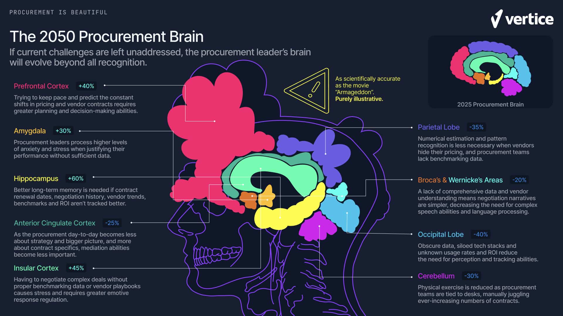 The "procurement brain" in 2050 | Vertice Blog